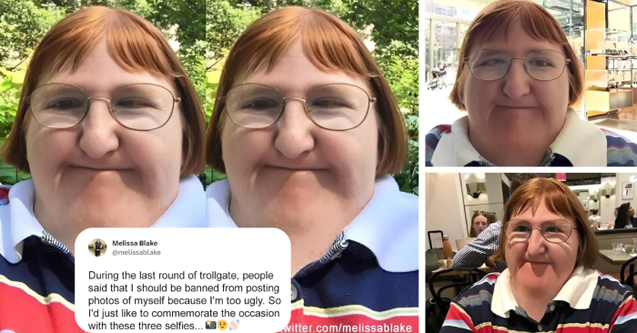 Woman Who Was Called ‘Too Ugly’ After Posting Her Photos Proves Bullies ...