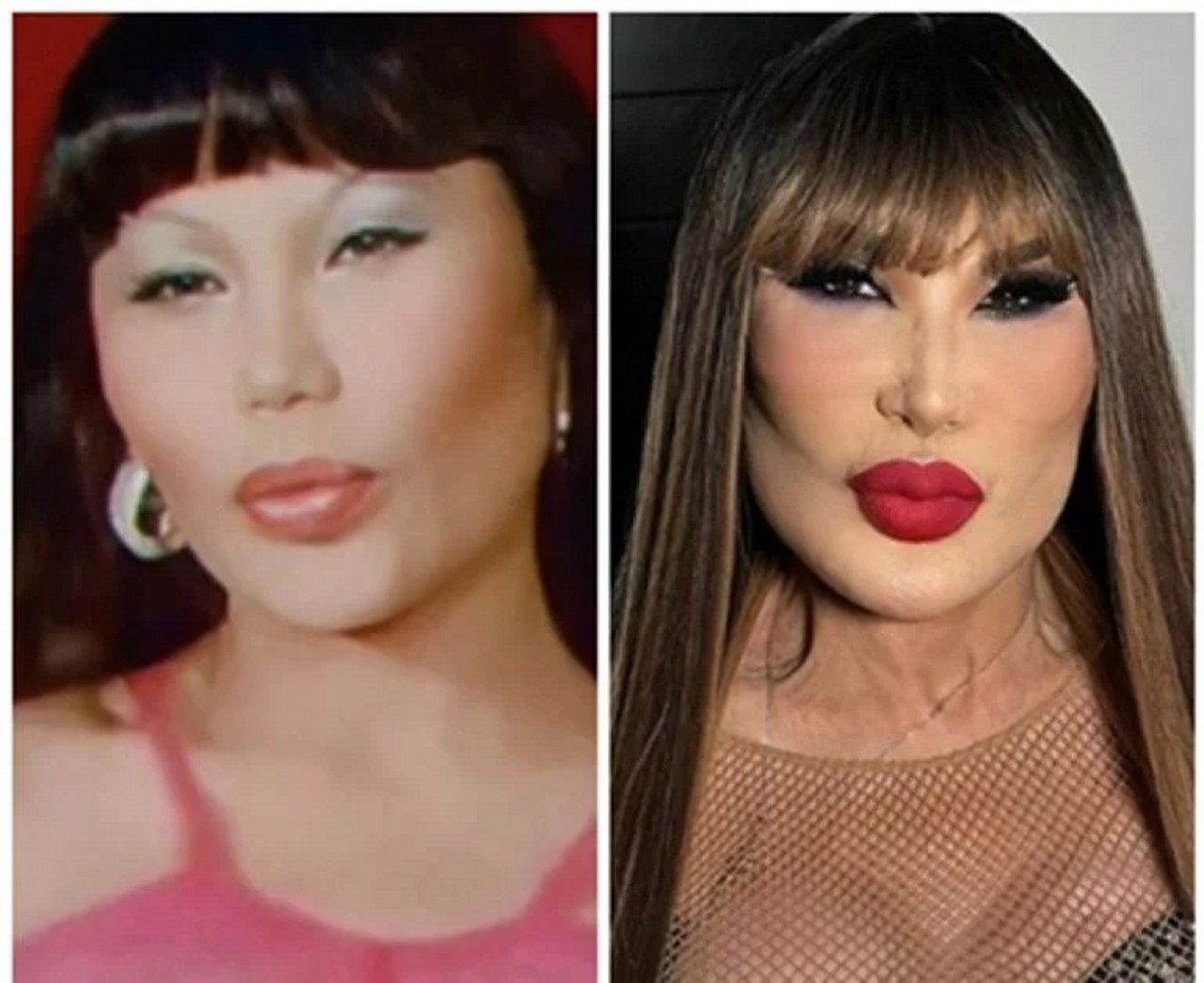 Lyn May The Pain Behind the Spotlight